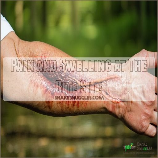 Can a Water Moccasin Kill You? The Shocking Snake Bite Truth!