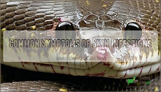 How to Treat Snake Skin Infection: Expert Solutions That Work