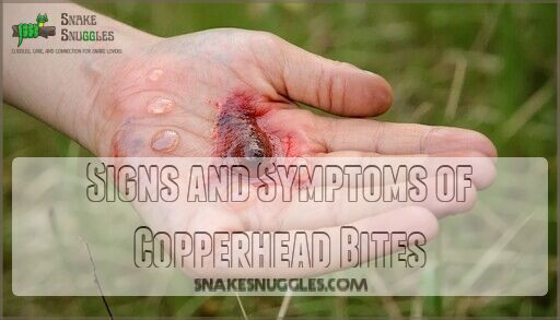 Copperhead Snake Venom Enzymes: Toxins, Treatment & Medical Uses